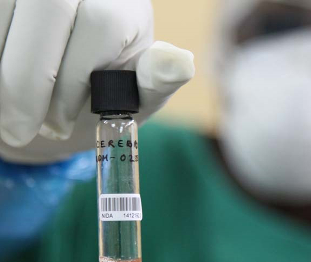 Learning from Death to Improve Health Around the World | RTI